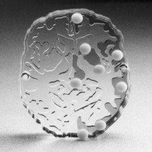 Hoffman 2D Multi-Compartment | ELSE Solutions